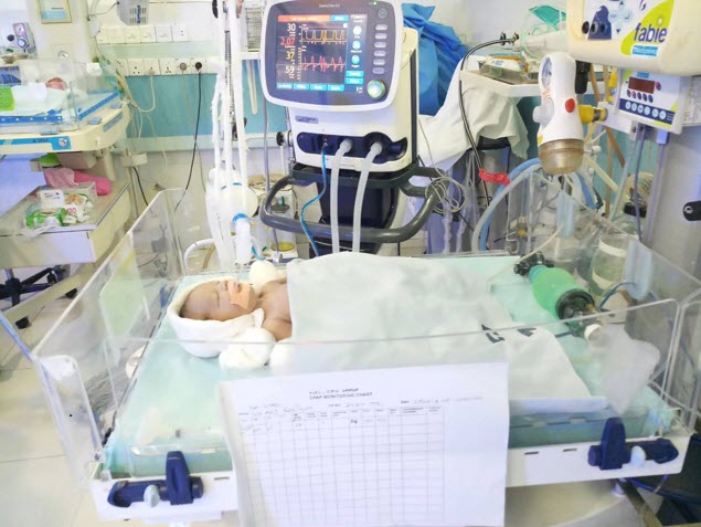 CONVERSION OF FETAL CIRCULATION - KIDS HEART FOUNDATION (KHF)