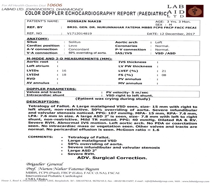 ECHO CARDIOGRAPHY Sequential segmental analysis | Congenital Heart Desk ...