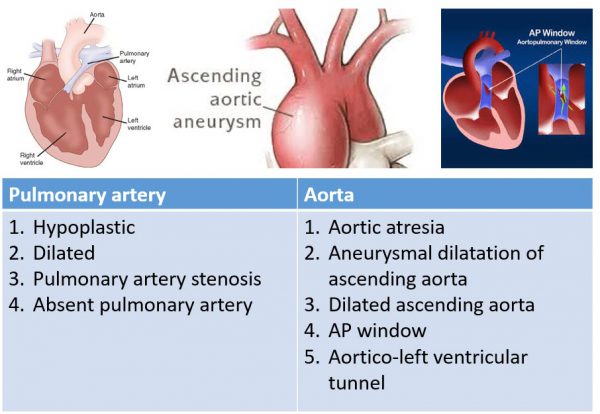 ECHO CARDIOGRAPHY Sequential segmental analysis | Congenital Heart Desk ...